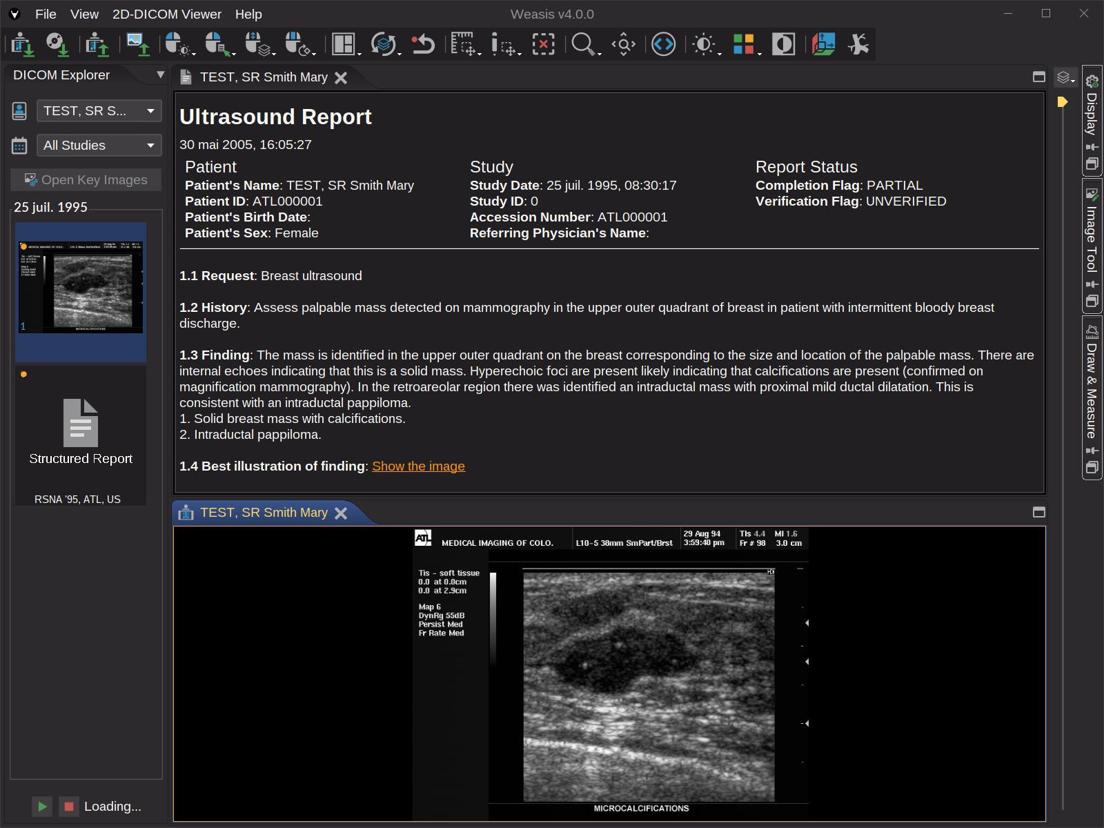 Weasis: Free DICOM viewer :: Weasis Documentation